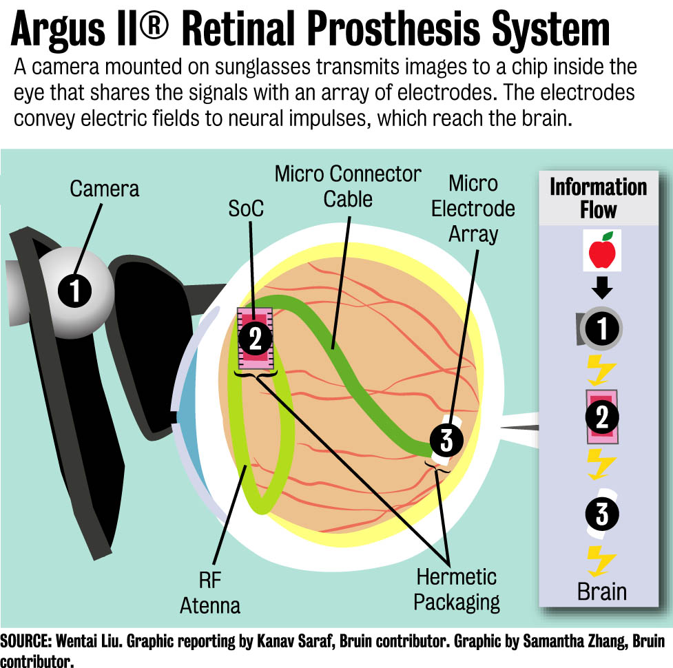 Professor helps develop ‘artificial retina’ - Daily Bruin