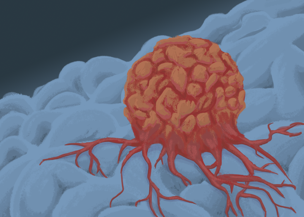 UCLA researchers advance cancer treatment aiming to target tumors ...